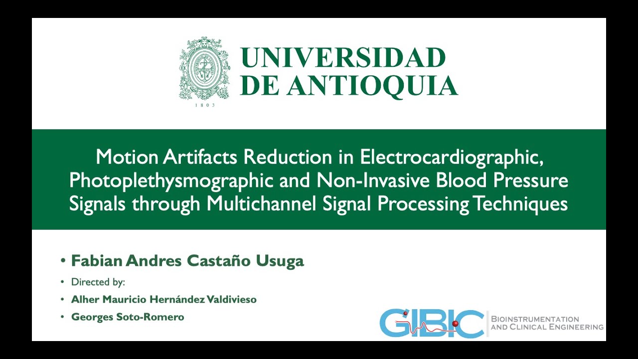 PhD Dissertation, Fabian Castaño, Motion Artifacts Reduction in ECG ...