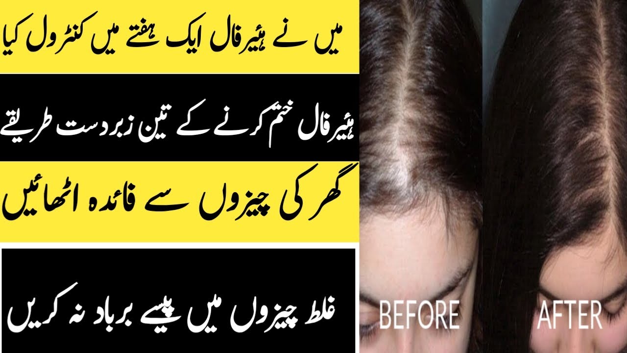 How To Control Extreme Hair Fall In 1 Week|3 Ways To Hairfall Solution ...