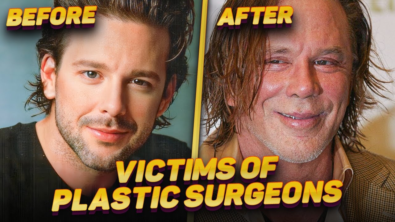 Hollywood celebrities after unsuccessful plastic surgeries - YouTube