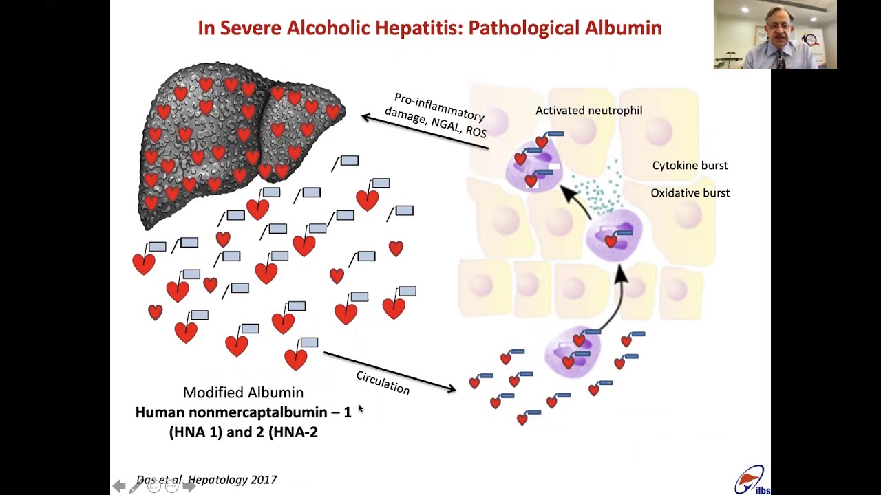 Dr SK Sarin lecture - YouTube