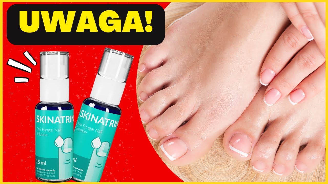 Skinatrin - Skinatrin na Grzybicę Paznokci - Skinatrin Opinie ...