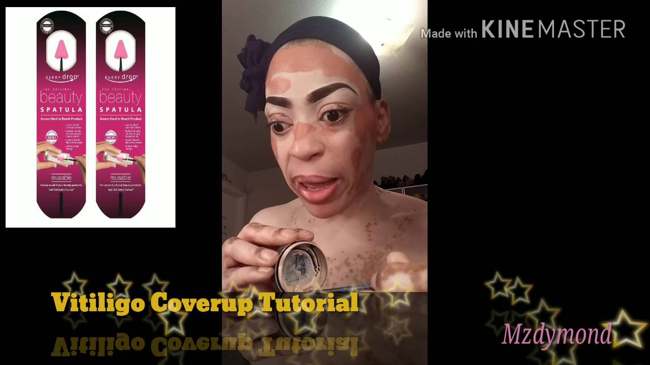 Turtorial: How I Cover My Vitiligo - YouTube