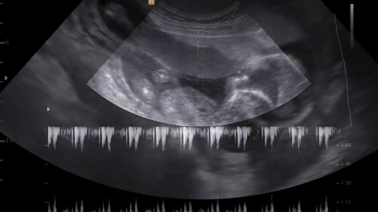 Jessica Nowicki - YouTube