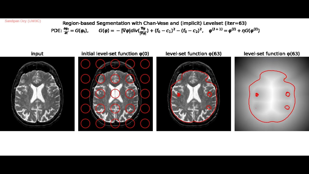 Region-based Segmentation | Chan-Vese | Snakes | Level Sets | Gradient ...