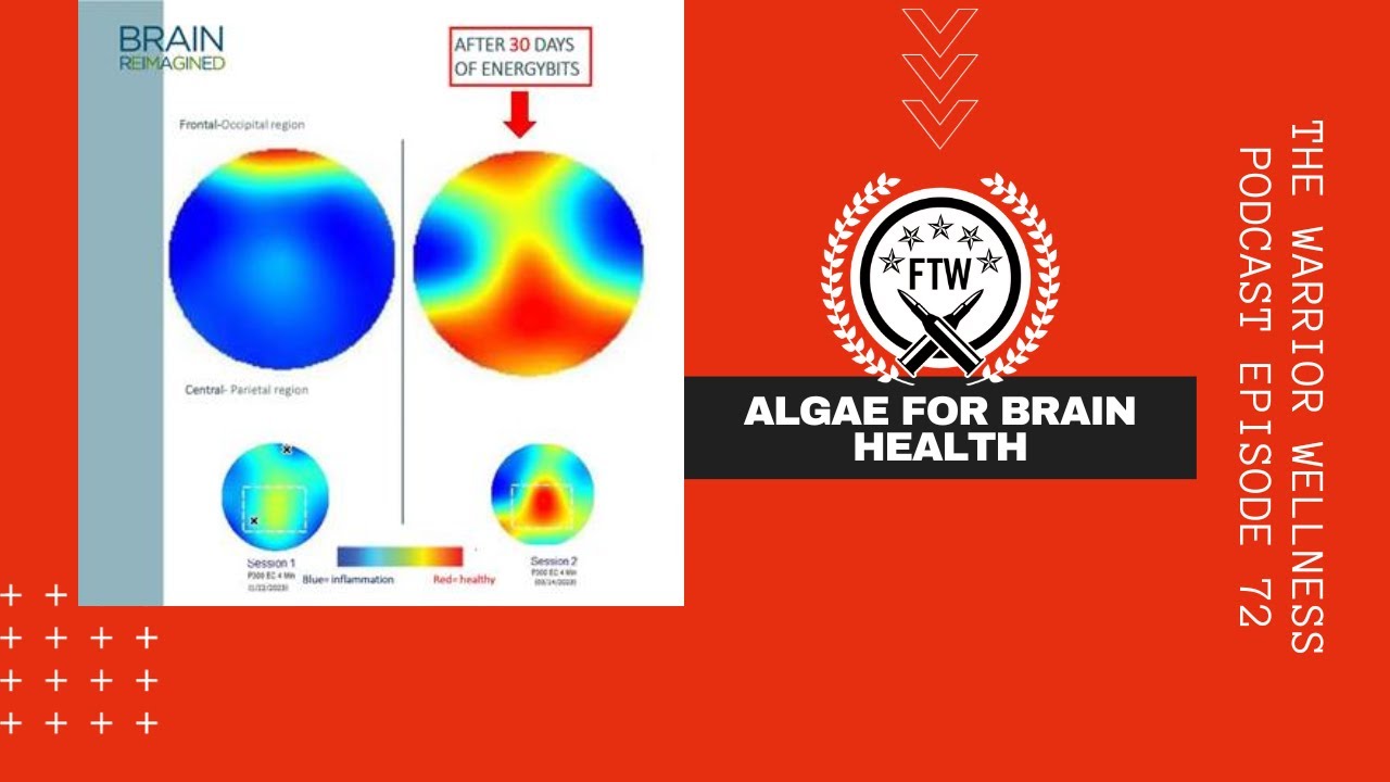 Algae for Brain Health - YouTube