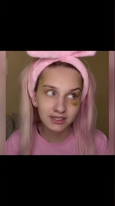 Даша Корейка ПОСЛЕДСТВИЯ ПОСЛЕ ОПЕРАЦИИ 😧😳😨 Youtube