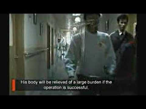 Elephant man from China - YouTube