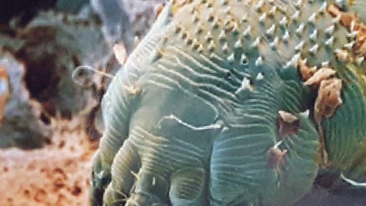 Scabies KL - YouTube