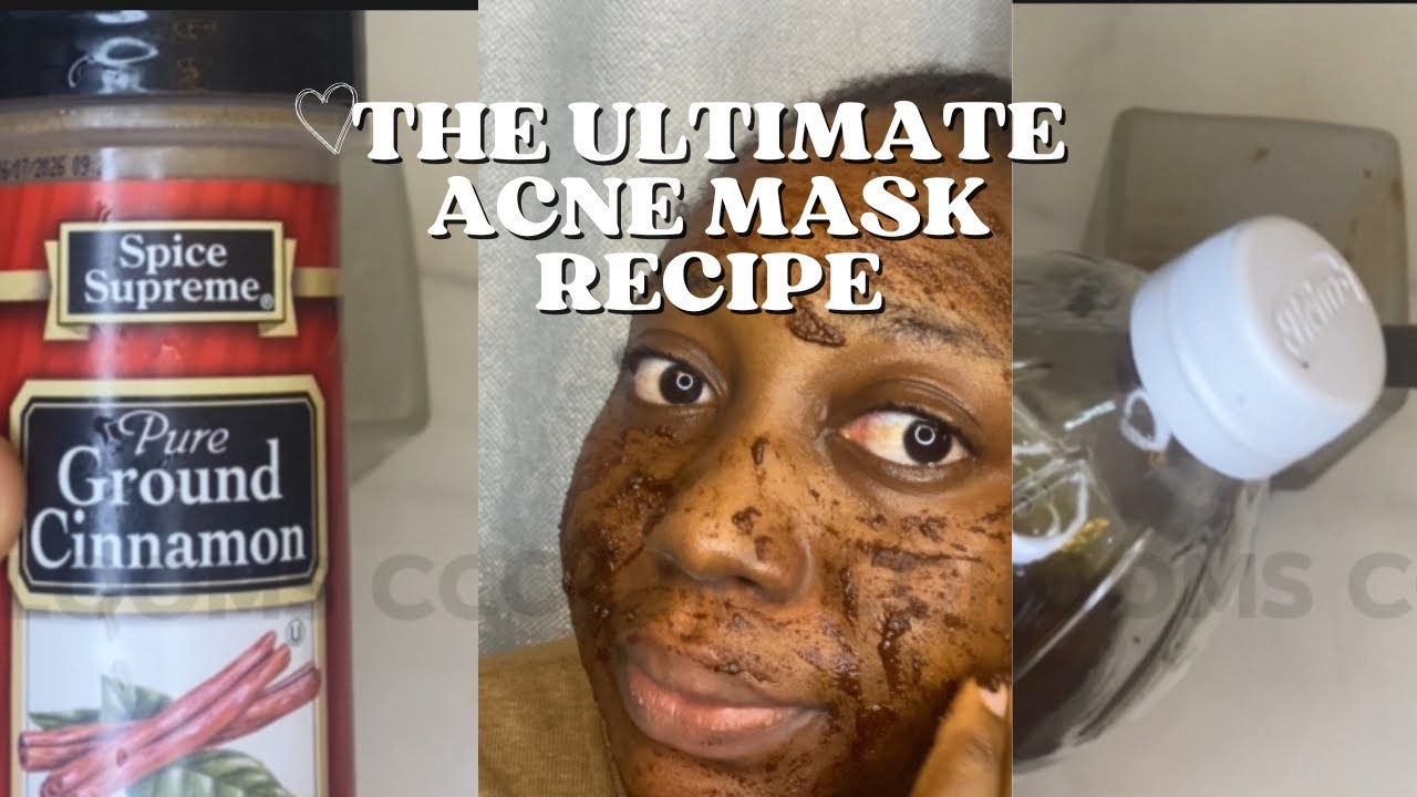 Discover the magic of this homemade acne mask! - YouTube