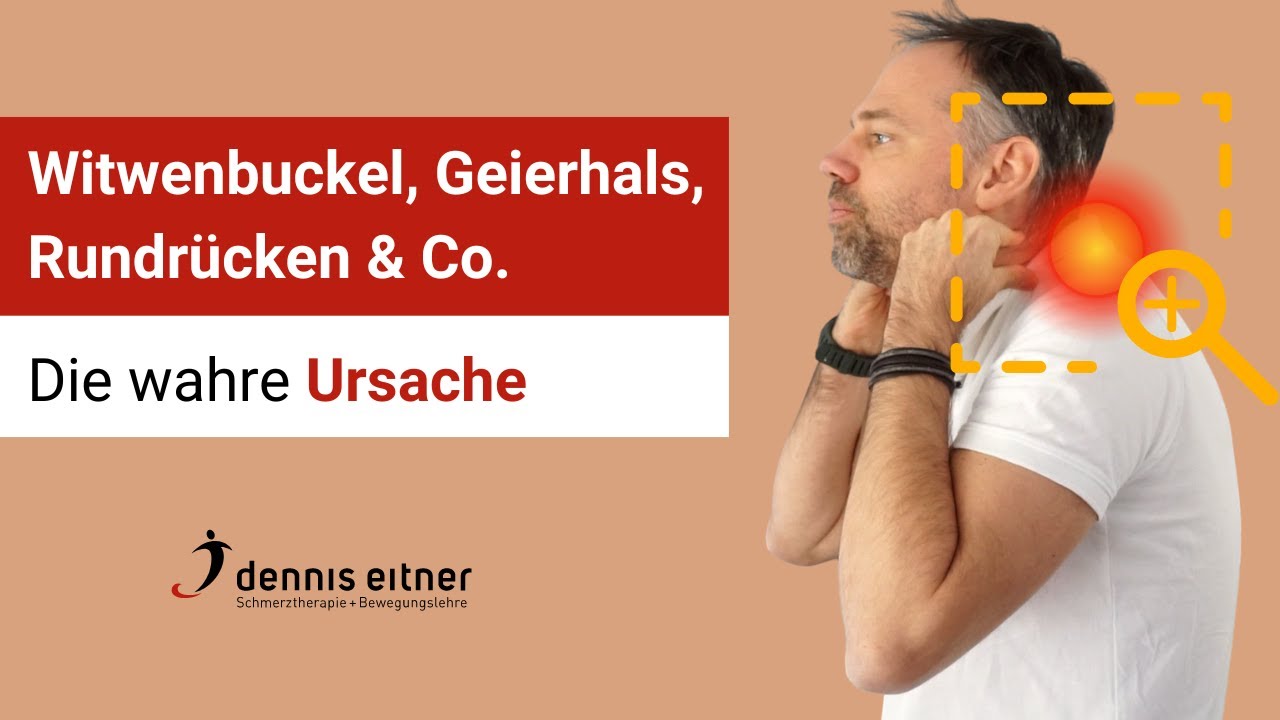 Schmerzen an der Halswirbelsäule verstehen und beseitigen ...