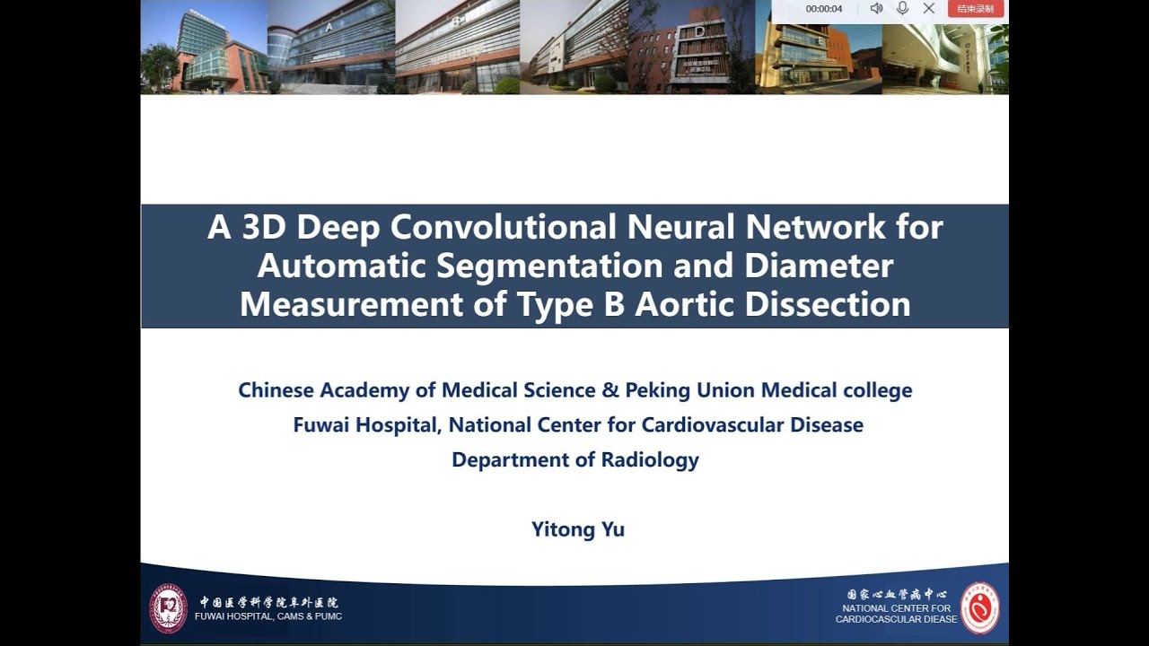 [Listen to Authors] AI-Guided Segmentation and Measurement of Type B ...