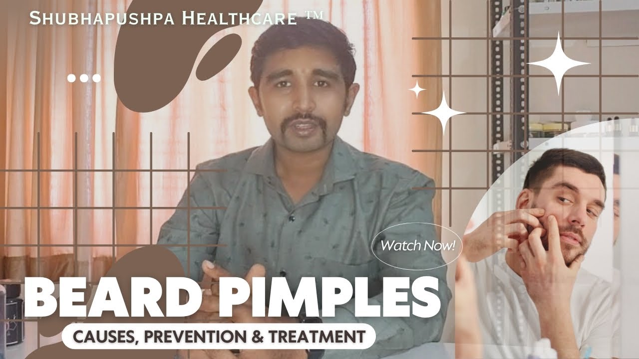 "Beard Pimples: Causes, Prevention & Best Treatments for Clear Skin ...
