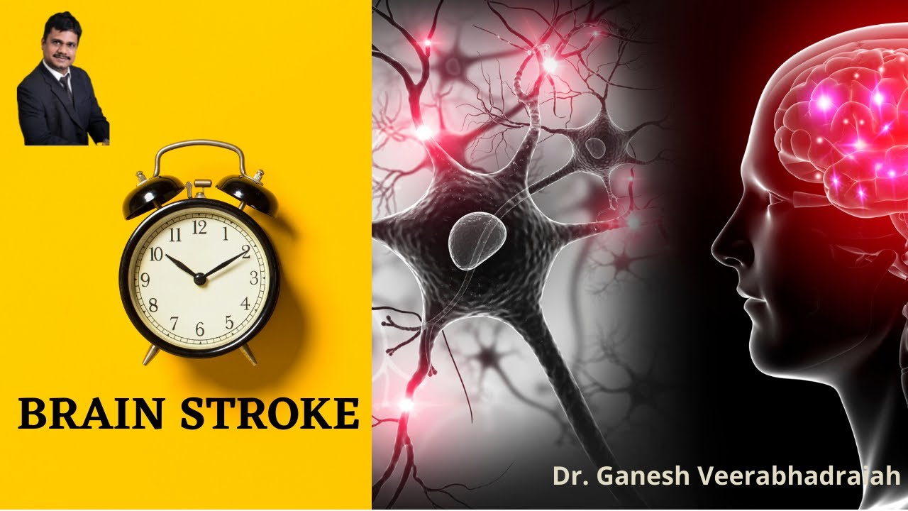 Brain attack- what are types, its reasons, treatment medical and ...