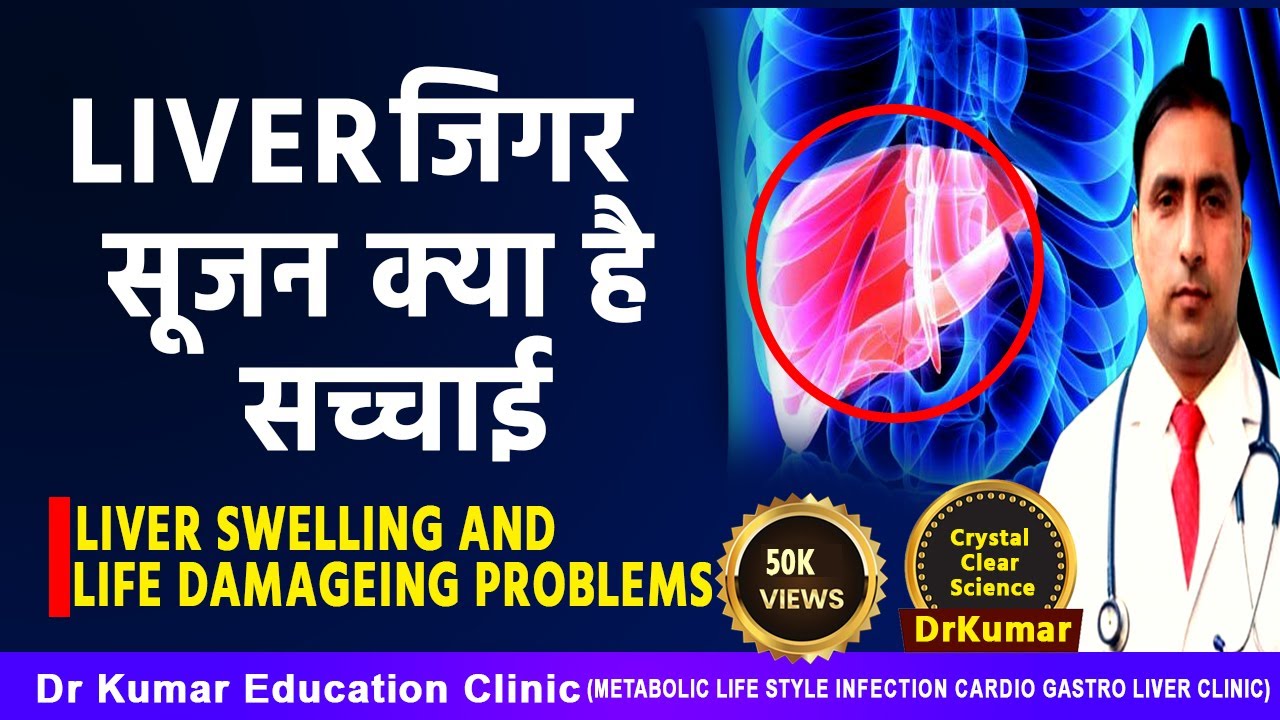 LIVER SWELLING CAUSES AND TREATMENT || Dr Kumar education clinic - YouTube