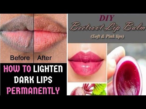 DARK LIPS⁉️How to Lighten your Dark Lips Permanently/ No more chapped ...
