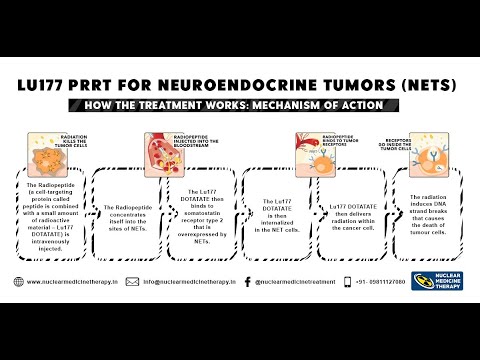 Lu177 PRRT For Neuroendocrine Tumors Nets - YouTube