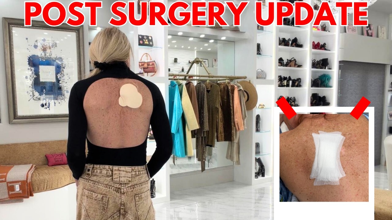 POST SURGERY UPDATE - YouTube