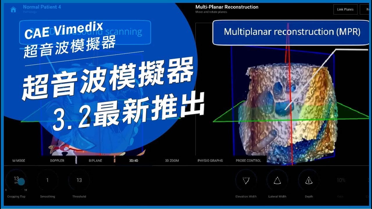CAE 超音波模擬器 Vimedix 3.2 現正推出 - YouTube