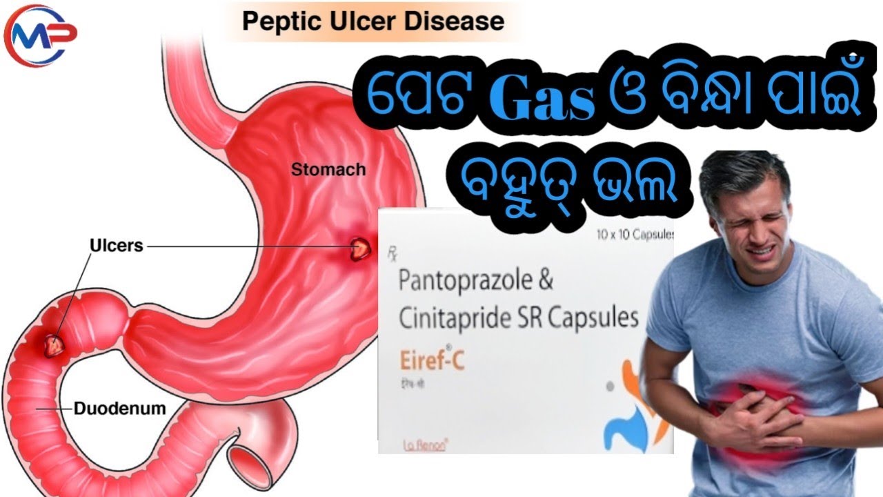 Eiref-C_SR_Capsules_Uses_Benefits_And_Side_Effects#pantoprazole And ...