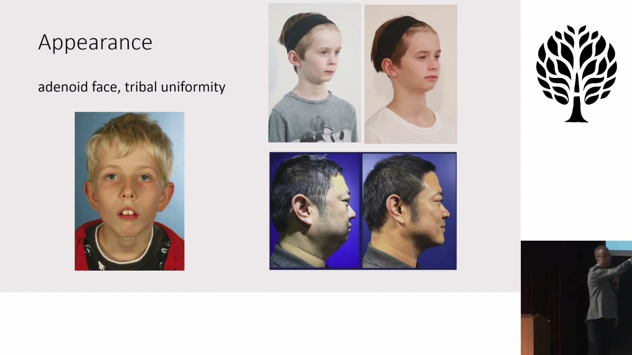 Mike Mew, BDS - Changing the face of evolutionary medicine (AHS22 ...