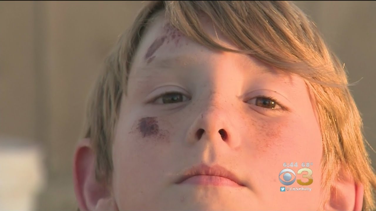 Boy Injured After Flying Out Of Bounce House And Onto Highway - YouTube