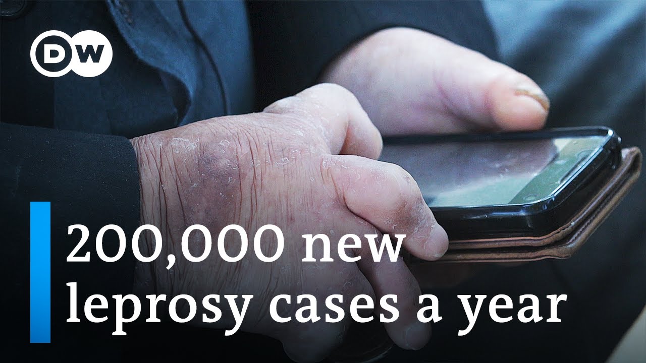 Why leprosy still disables millions of people worldwide | DW News - YouTube