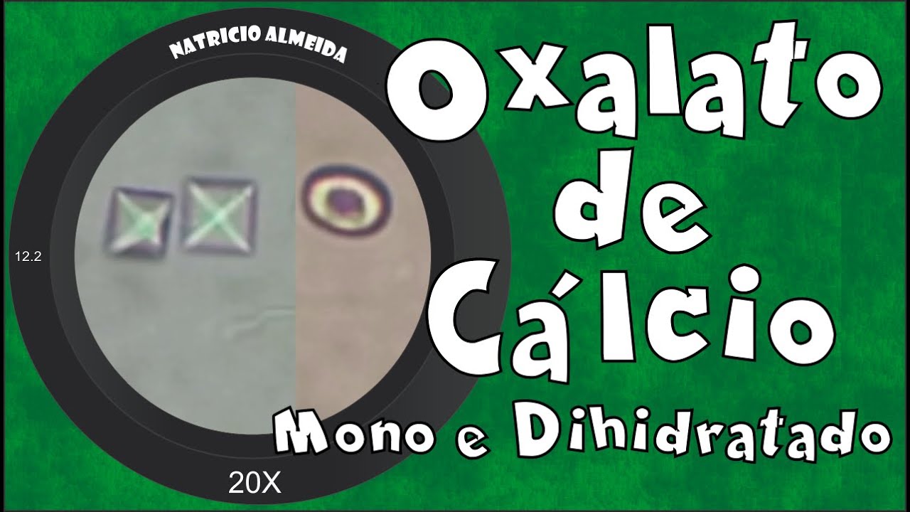 Cristais De Oxalato De Calcio Monohidratado - BRAINCP