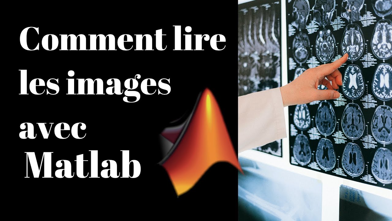Comprendre et lire les images médicales DICOM avec Matlab - YouTube