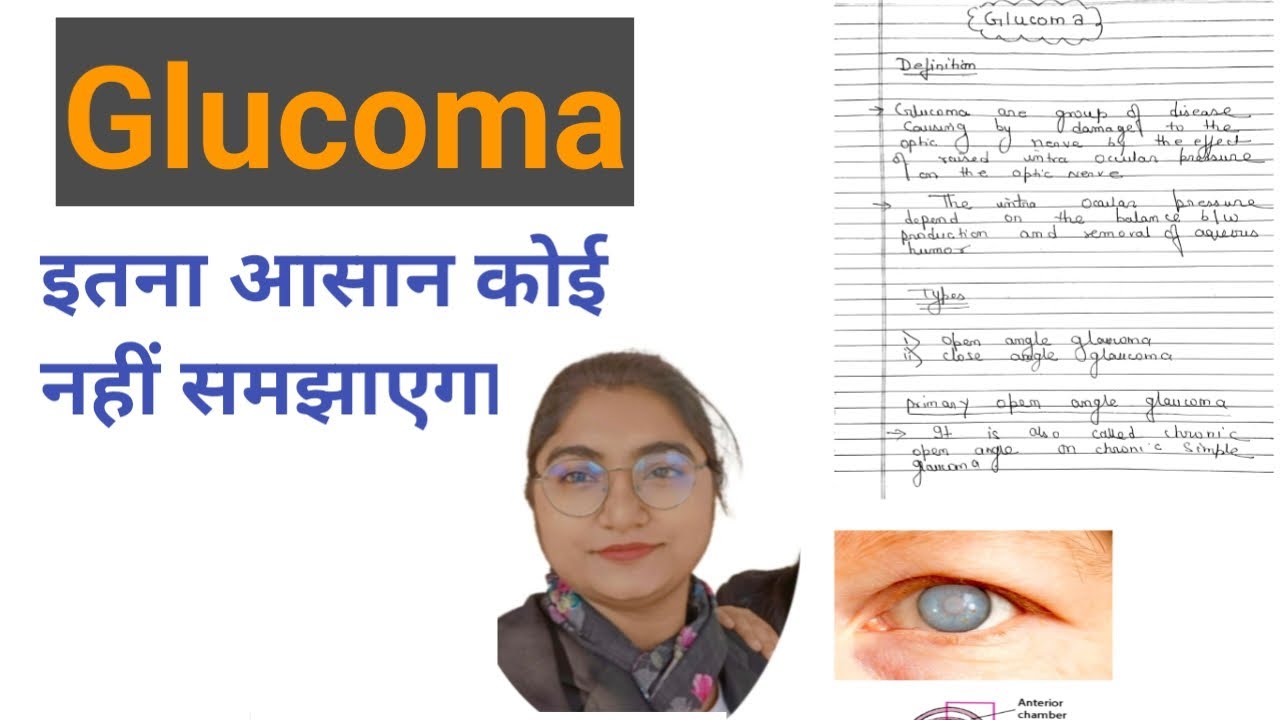 Glucoma notes eye disorder part 1| Glucoma medical surgical nursing ...
