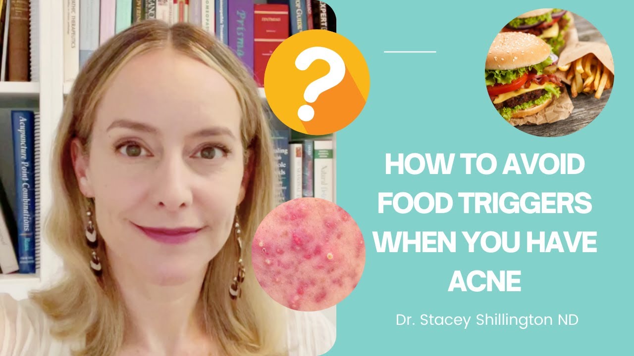How to avoid food triggers when you have acne - YouTube