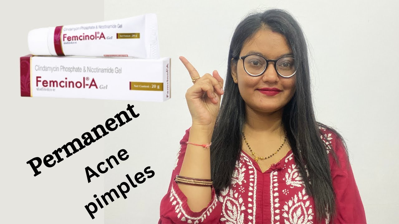 Permanent acne & pimples treatment @Kiransrana - YouTube