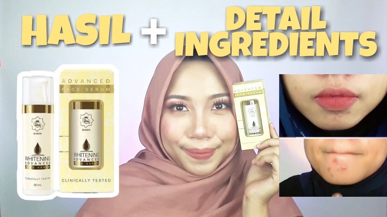 12 HARI PAKAI VIVA QUEEN WHITENING ADVANCED FACE SERUM - YouTube