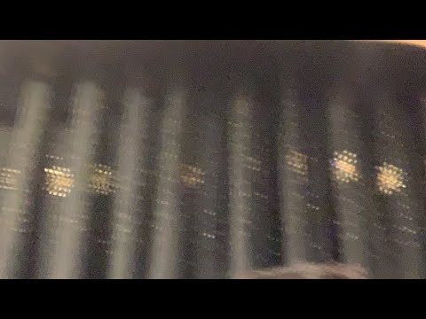 Parks 3 step test - YouTube