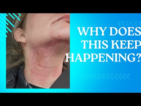 Devastating News.... and my neck is back to breaking out... why? - YouTube