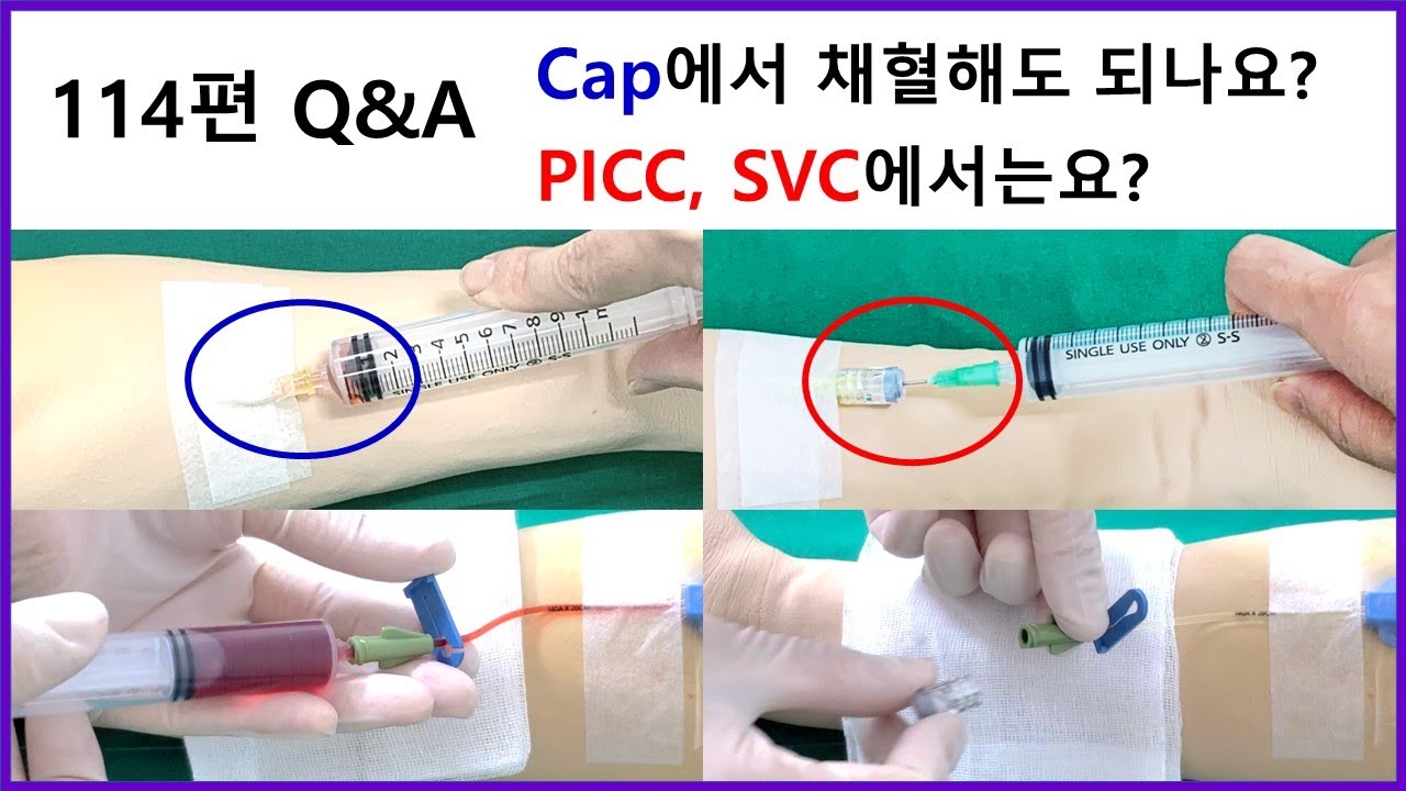 114. Q&A - cap, PICC에서 채혈해도 되나요? - YouTube