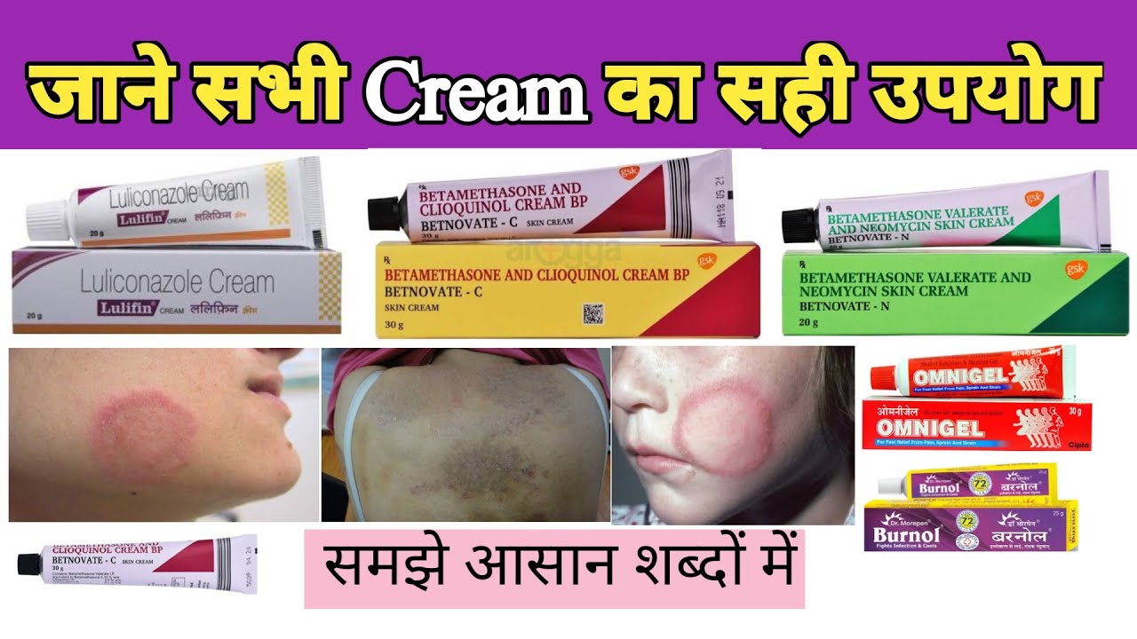 Face Cream Use | Antifungal Cream | Diclofenac cream | Pain killer ...