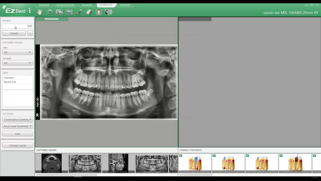 EZDent i, Chapter 04 01 Patient Search FINAL - YouTube
