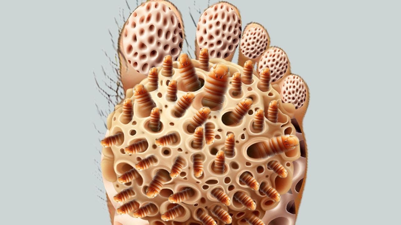 Unbelievable ASMR Foot Treatment Animation - YouTube