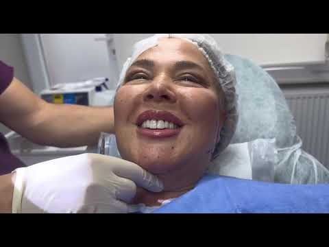 Safiye Soyman Op. Dr. Volkan Kıyak'a  Boyun ve Yarım Yüz Germe  ile Estetik Ameliyatı olurken,