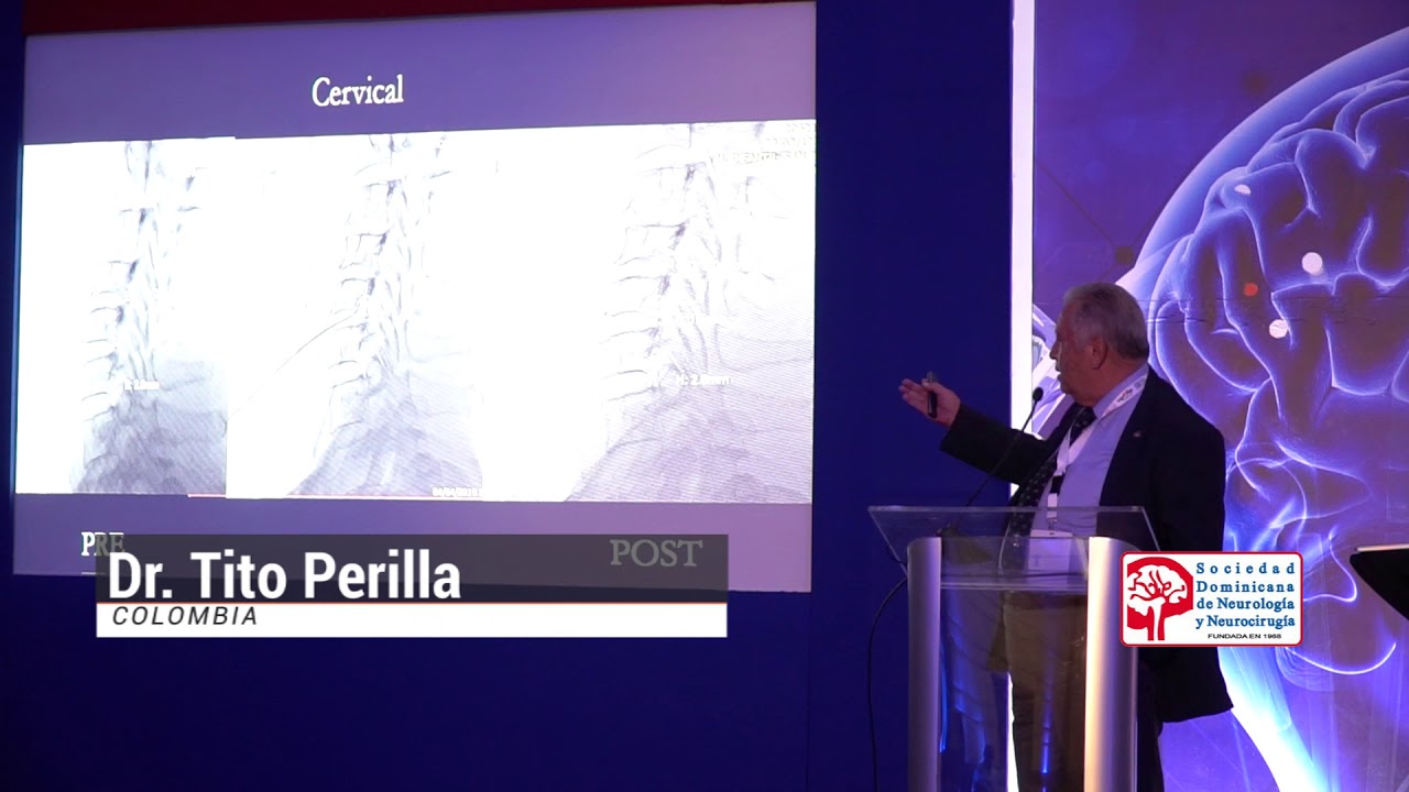 Dr Tito Perilla, Colombia - YouTube