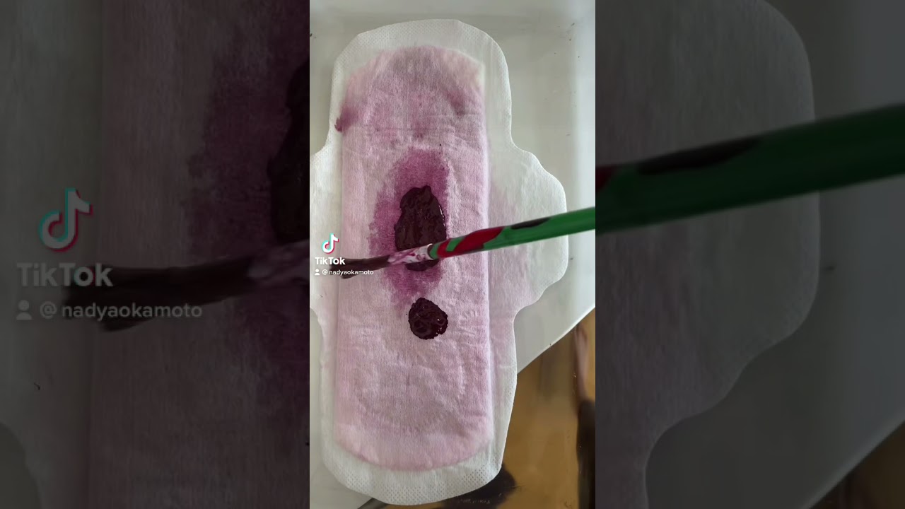 Female Period Blood Clots