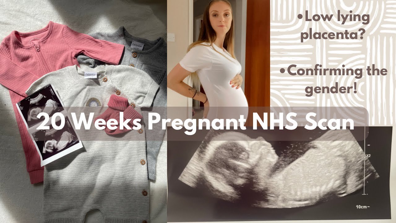 20 Week Anatomy Scan | Confirming the Gender, Low Lying Placenta? - YouTube