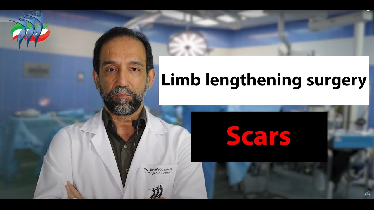 The scars from the height increase surgery - YouTube