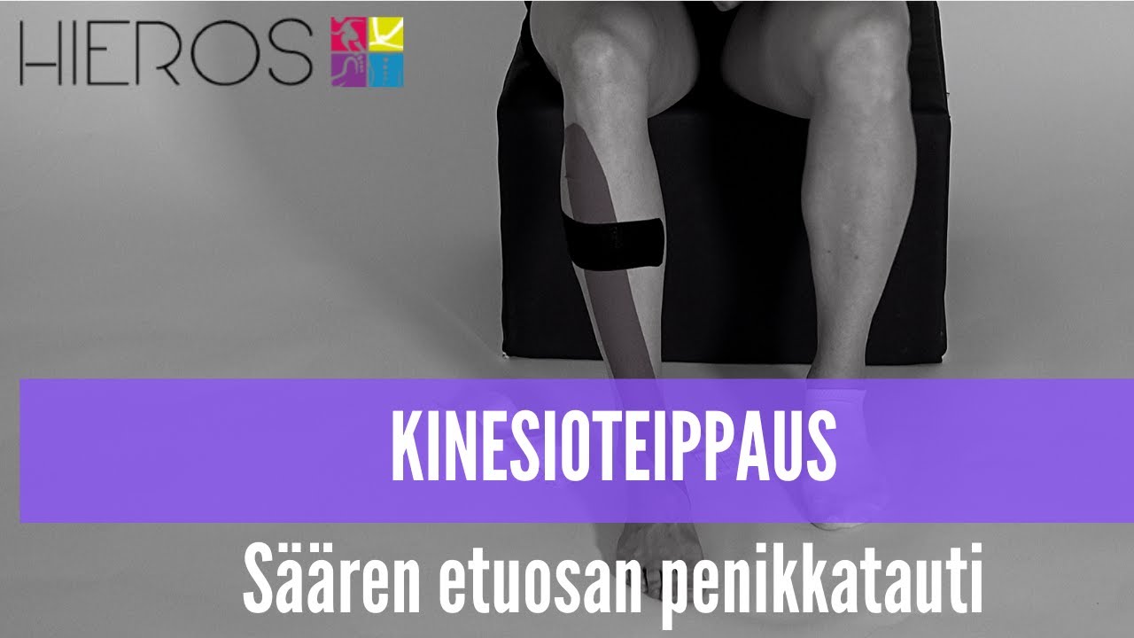 KINESIOTEIPPAUS | Säären etuosan penikkatauti - YouTube