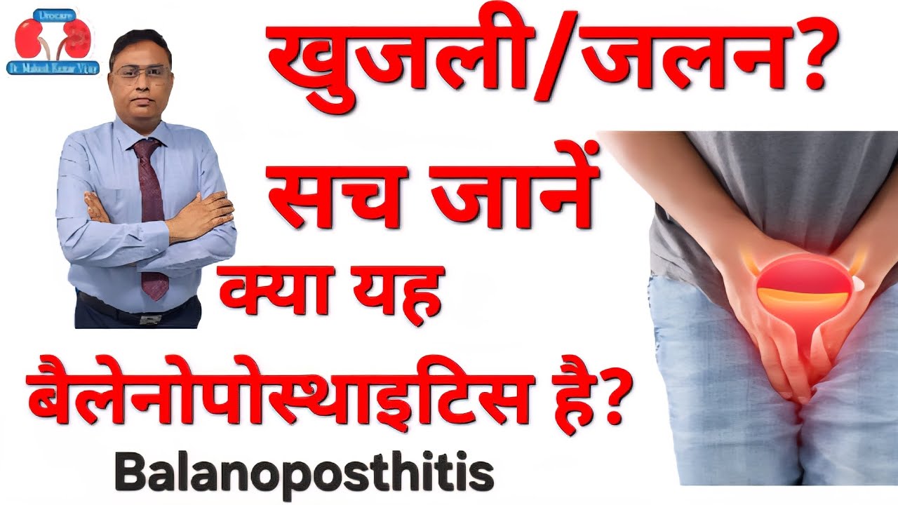 जलन, लालपन या दर्द? हो सकता है बैलेनोपोस्थाइटिस! Balanoposthitis Real ...