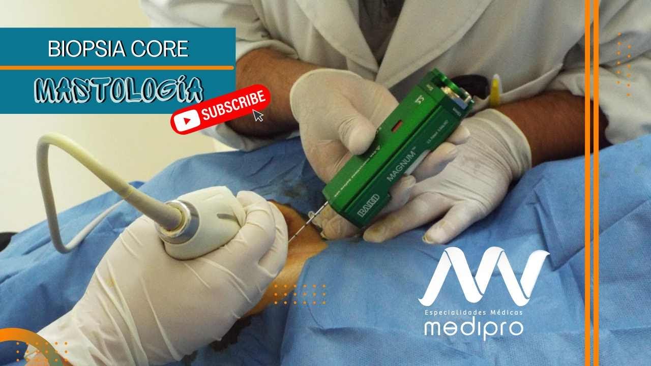 EP 53 - Biopsia CORE en mamas! - ¿Cómo se hace? - YouTube