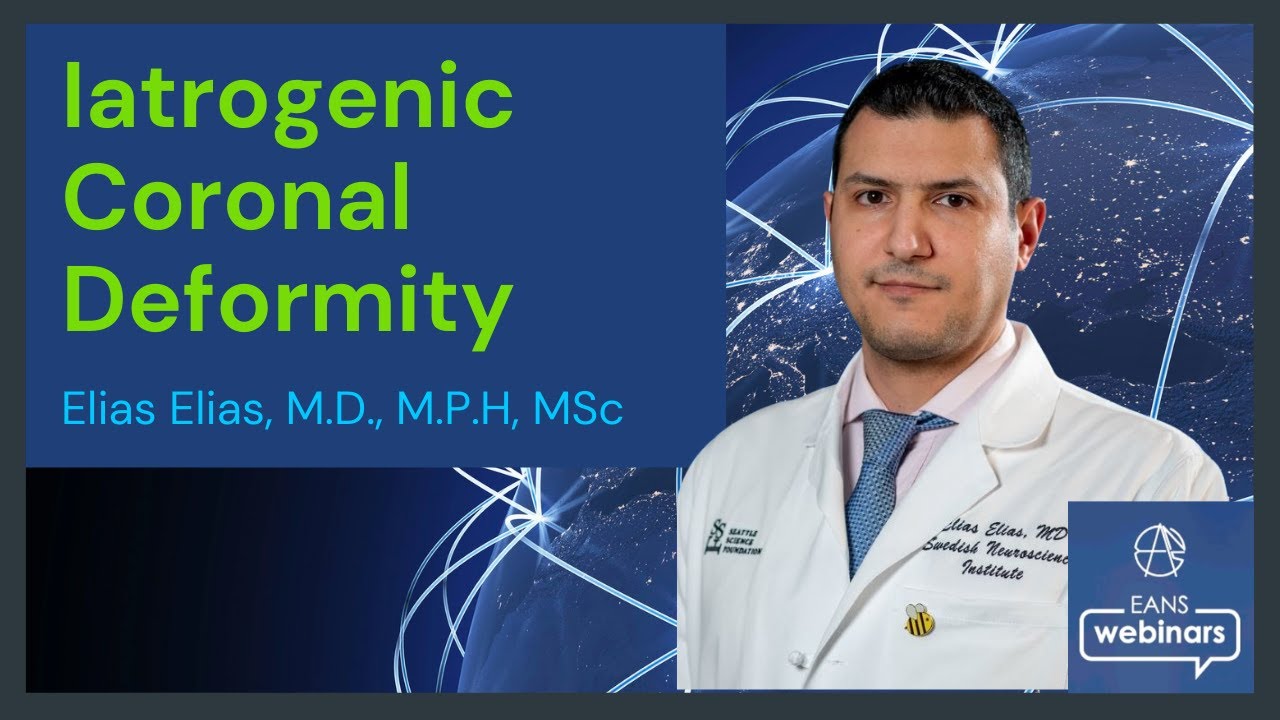 Iatrogenic Coronal Deformity - Elias Elias, MD, MPH, MSc - YouTube