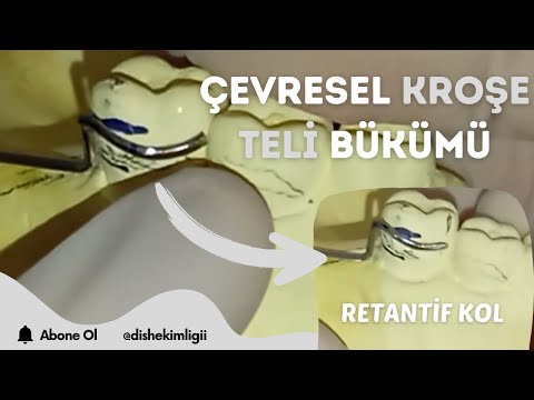 Çevresel Kroşe Bükümü- Retantif Kroşe Kolu