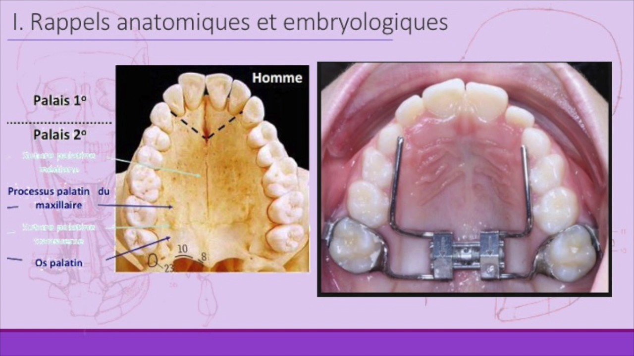 Bases anatomiques de la disjonction palatine - YouTube