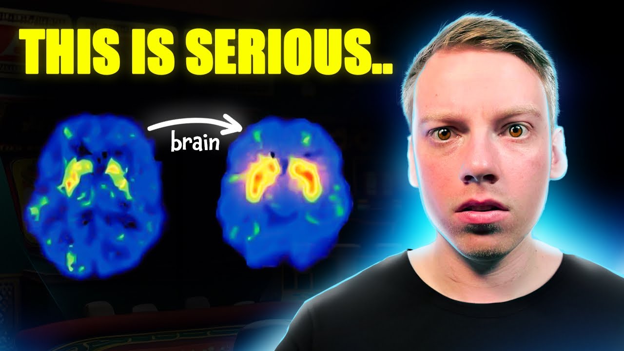 Gambling, Drugs And Alcohol: The Same Addiction In The Brain - YouTube